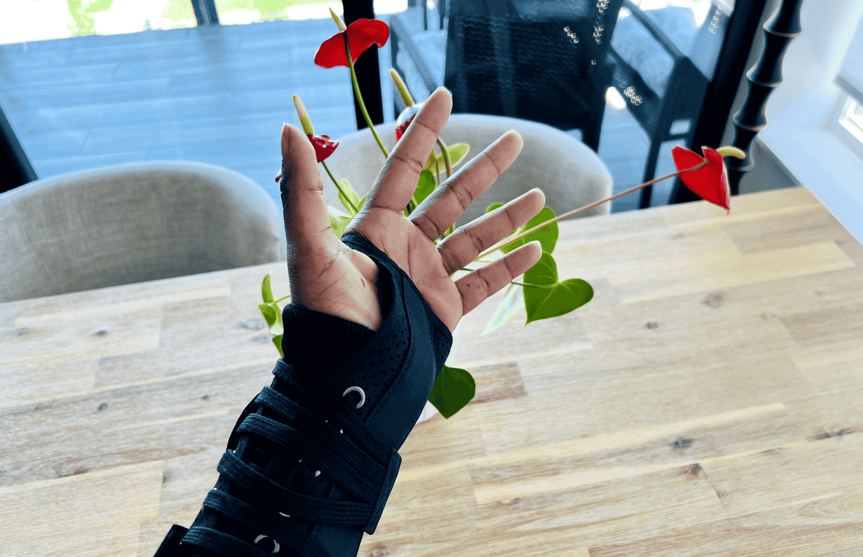 I Broke My Wrist: My Journey Through Distal Radius Fracture Recovery ...